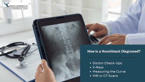 Can a Chiropractor Help With Hunchback?