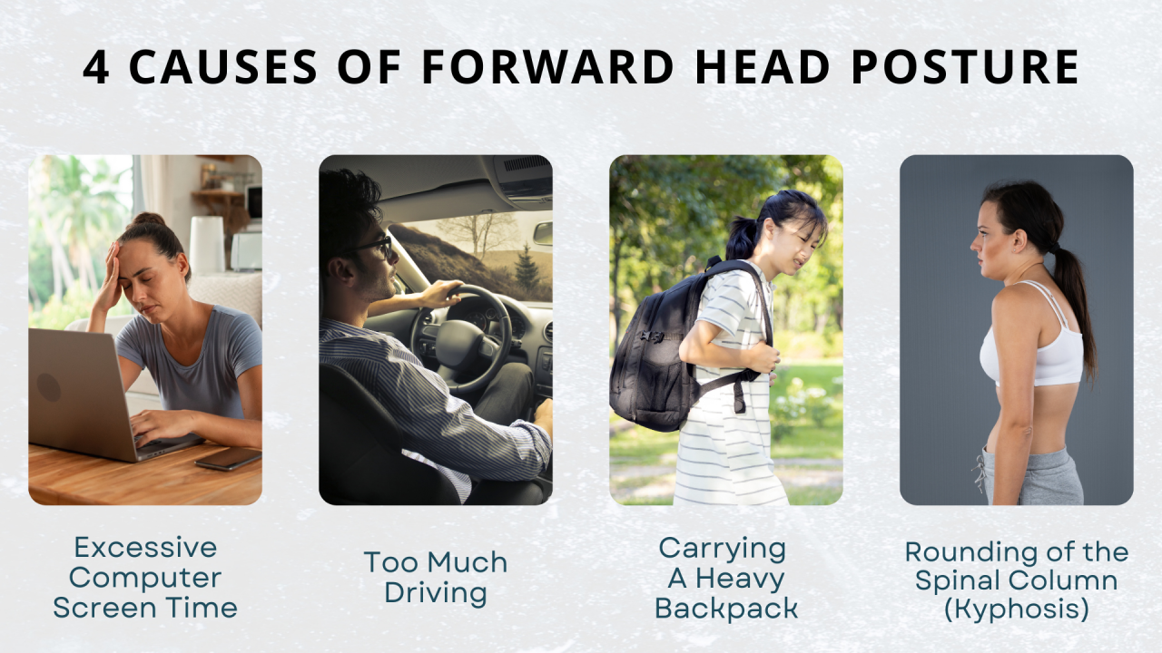 Can a Chiropractor Fix Forward Head Posture?