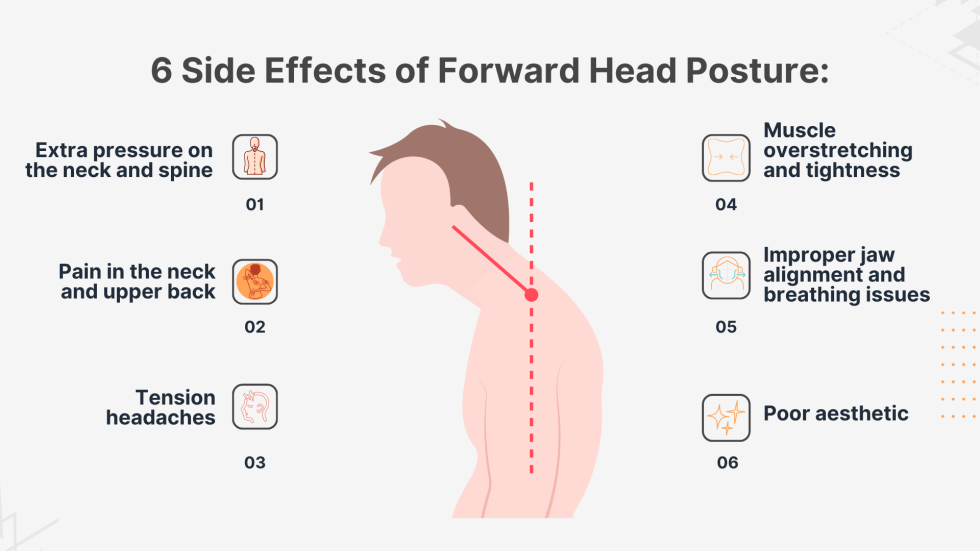 Can a Chiropractor Fix Forward Head Posture?