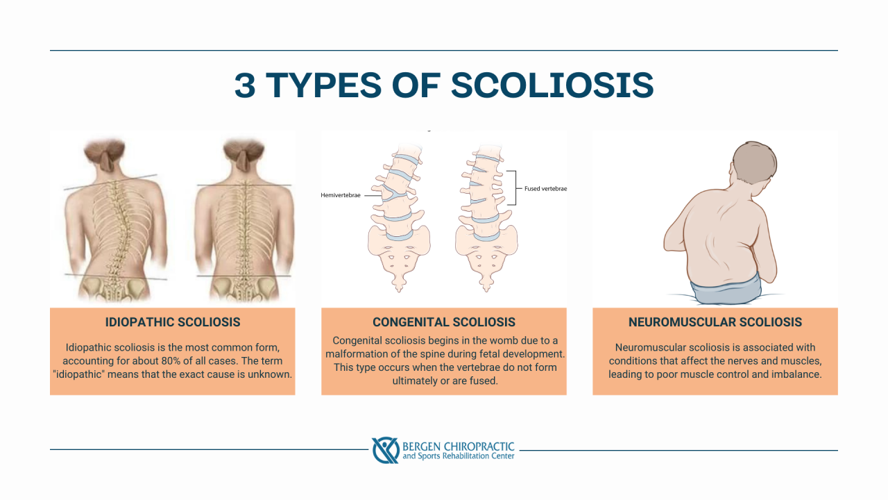 The Role of Chiropractic Care in Scoliosis Management