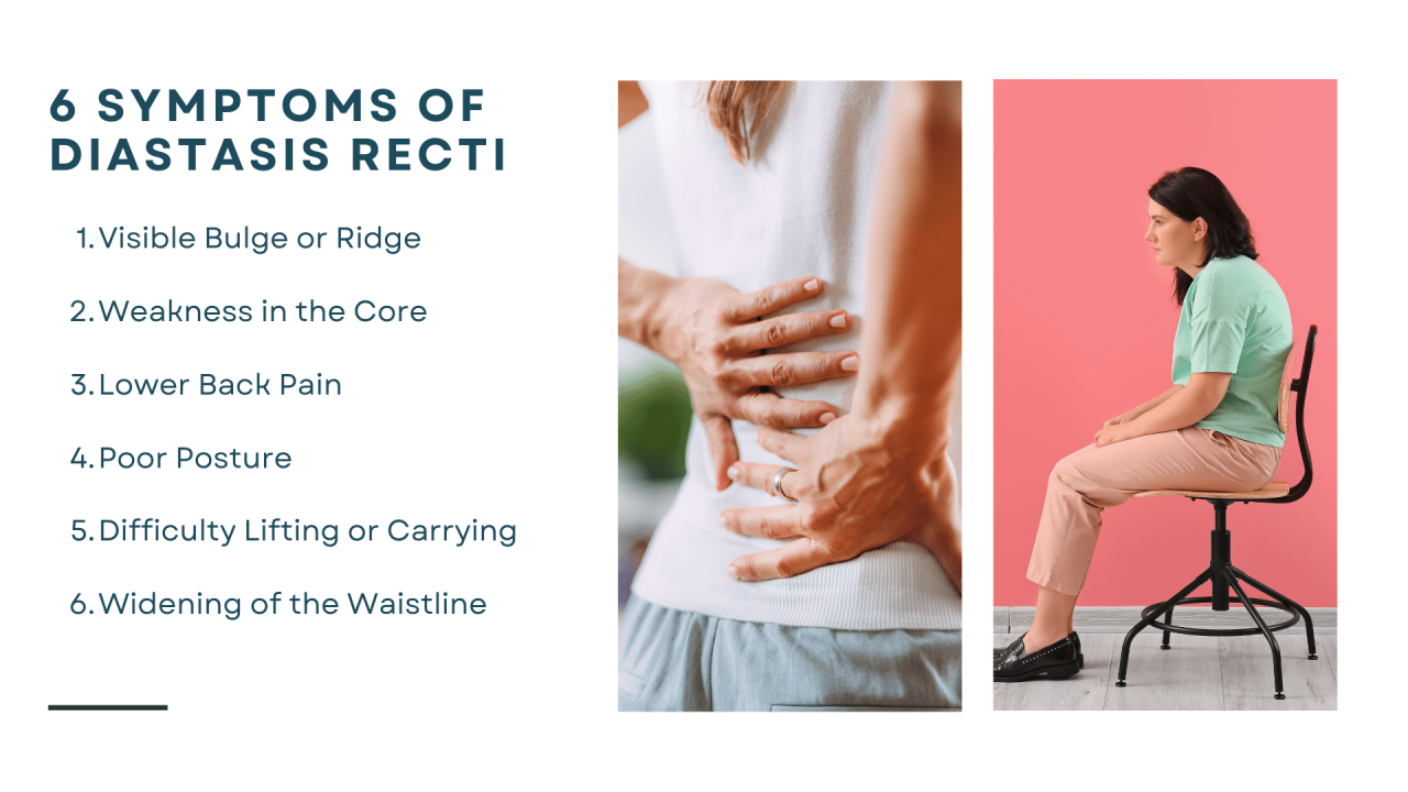 Chiropractic Care for Treating Diastasis Recti