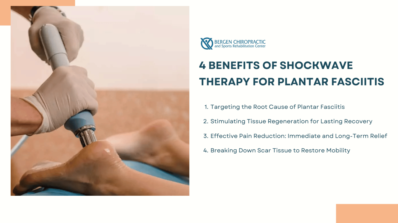 Shockwave Therapy for Plantar Fasciitis in Bergen County, NJ